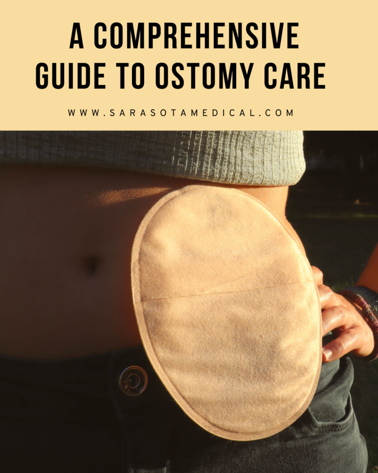 Ostomy Care: A Comprehensive Guide by Sarasota Medical Products in Florida